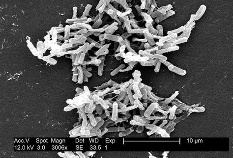 C Difficile Fecal Transplant Docs Battle Tough Strain With