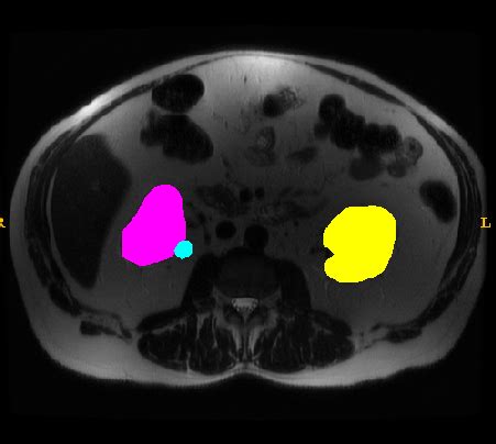 Python DICOM To NIFTI Conversion Stack Overflow