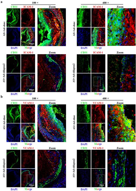 Effects Of Kpna2 Knockdown On The Secretion Of Adhesion Molecules In