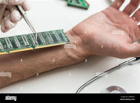 Hand With Implantation Of Micro Chip X Ray View Close Up Chipization Of People Control