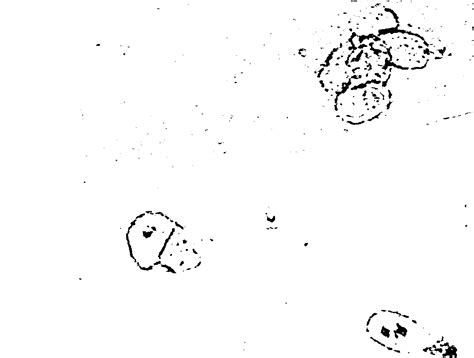 Stem Cell Regenerating Surface Cornea And Its Application In Corneal