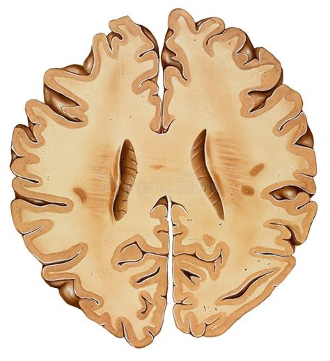 Brain Lower Region Cross Section Stock Illustration Illustration Of Brain Lower Region Cross Section Stock Illustration Illustration Of