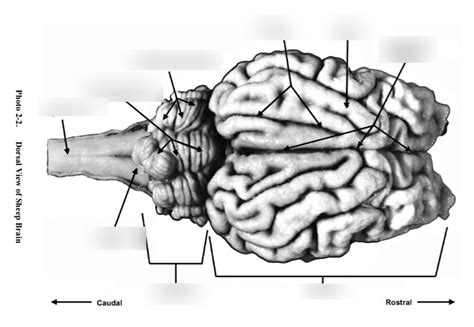 Dorsal View Of Sheep Brain
