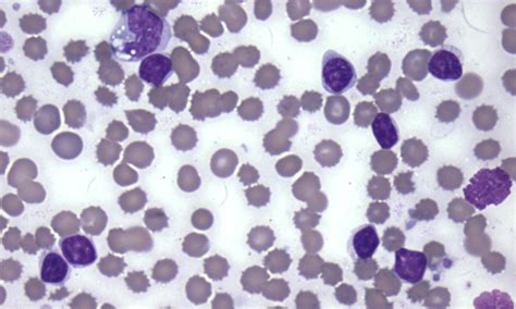 Top 5 Leukogram Patterns Clinicians Brief