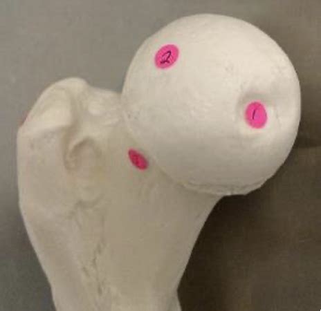 Femur Tibia Fibula Flashcards Quizlet