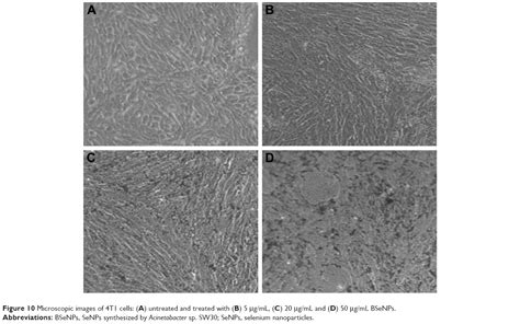 Green Synthesis Of Selenium Nanoparticles Using Acinetobacter Sp Sw30 Ijn