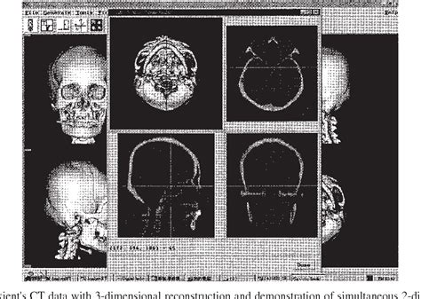 Figure 1 From Three Dimensional Computed Tomography Imaging In