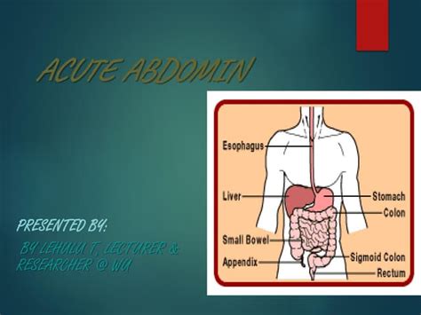 Acute Abdomen Presentation Ppt