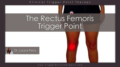 Rectus Femoris The Trigger Point Referred Pain Guide Vrogue Co