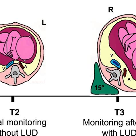 Description Of Timepoints For Comparison Of Hemodynamic Variables V Download Scientific