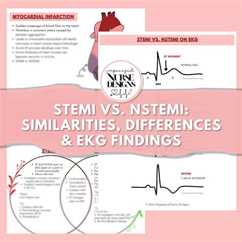 Stemi Vs Nstemi Artofit