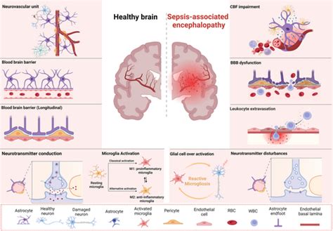 Recent Advances In The Pathogenesis Diagnosis And Treatment Of Sepsis