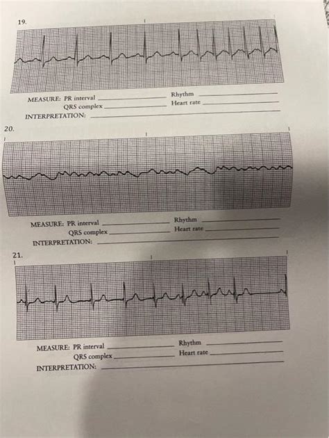 Solved Measure Pr Interva Qrs Complex Heart Rate
