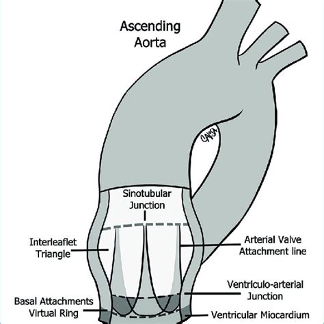 Schematic Representation Of The Aortic Root Highlighting The