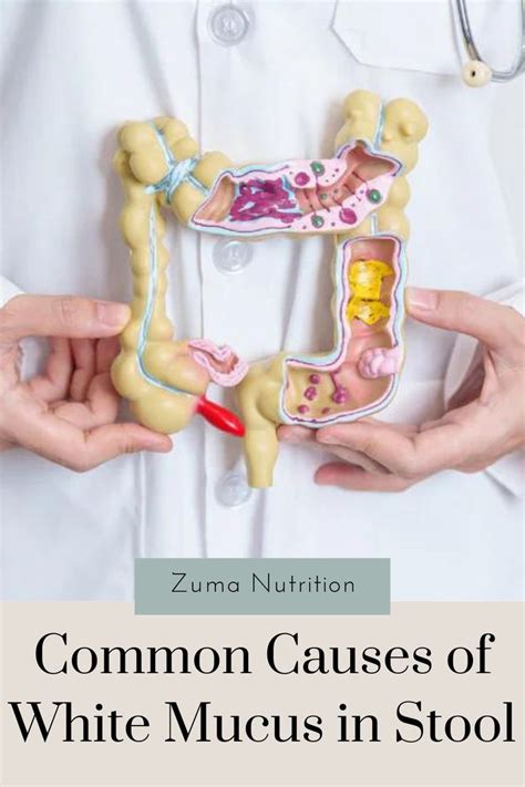 Understanding White Mucus In Stool Mucus In Stool Mucus Getting Rid