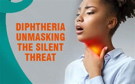 Diphtheria Unmasking The Silent Threat Er Of Watauga