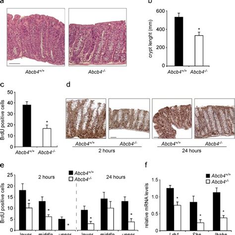Reduced Colonic Crypt Length And Decreased Cell Proliferation In The