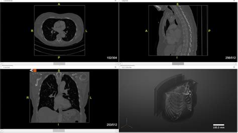 Medical Imaging Toolbox Matlab