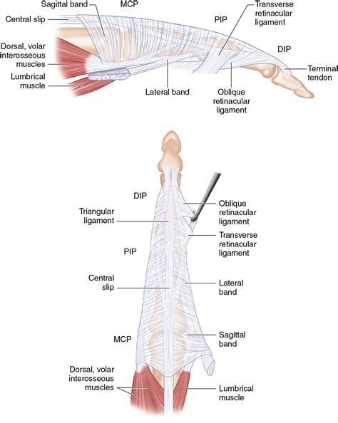 Acute Repair Of Extensor Tendon Injuries Zones I To Vii Clinical Tree
