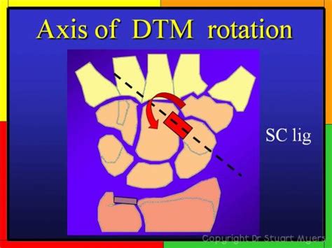 Dart Throwing Motion