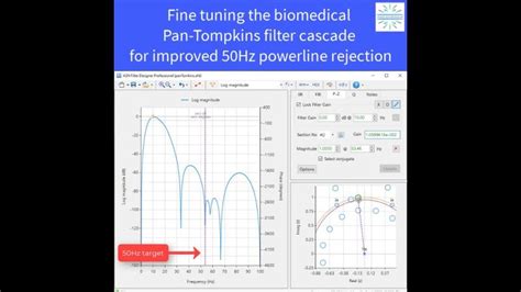 Dr Sanjeev Sarpal On Linkedin Ecg Signal Processing Tweaking Pan