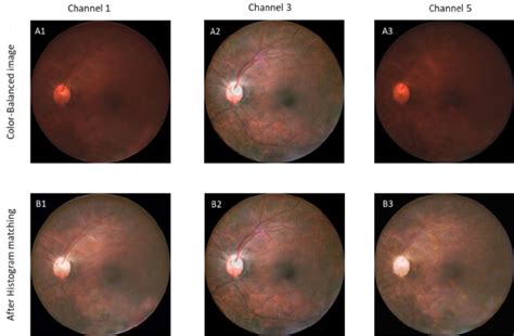 Comparative Evaluation Of Wavelength Dependent Location Sensitivity Of
