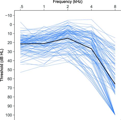 e pure tone audiometry hearing thresholds db hl for frequencies from