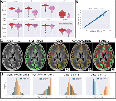 Comprehensive Analysis Of Synthetic Learning Applied To Neonatal Brain Mri Segmentation Paper