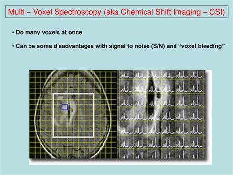 Ppt Dti Basics Water Diffusion In Mri Imaging Powerpoint