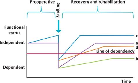 Is Prehabilitation Right For You Or Your Patient Momentum Physical