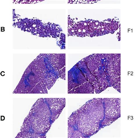 Visual Comparisons Of Converted Stains Select Regions Of Wsi In Both