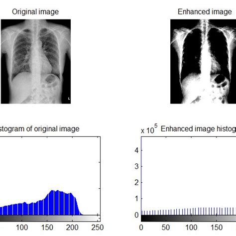 Histogram Comparison Of Lung Images Before And After Contrast