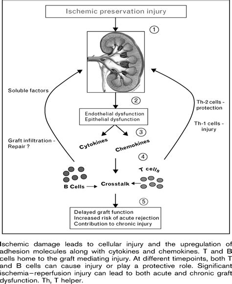Emerging Role Of T And B Cells In Preservation Injury Current Opinion