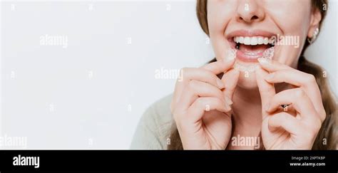 Smiling Woman Holds A Clear Teeth Aligner For Teeth Straightening With