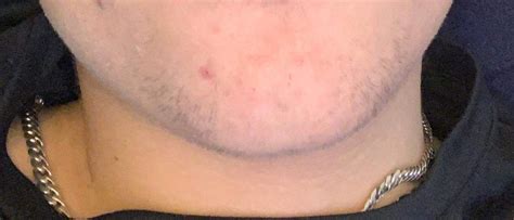 Wieso Wächst Der Bart Nicht Jungs Männer Aussehen