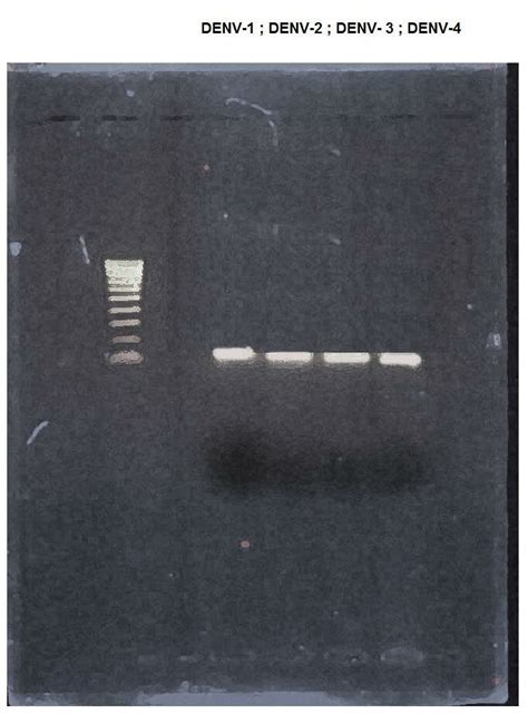 The Percentage Of Dengue Virus Serotypes As Identified By Real Time Download Scientific Diagram