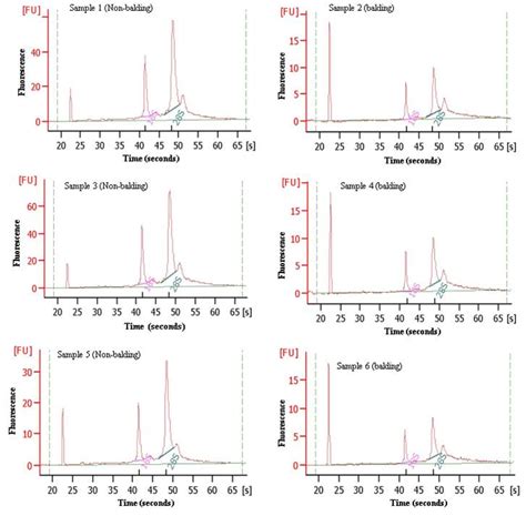 Figure 2 Electropherogram Of Total Rna Samples Rna Obtained From Balding N 3 And Normal