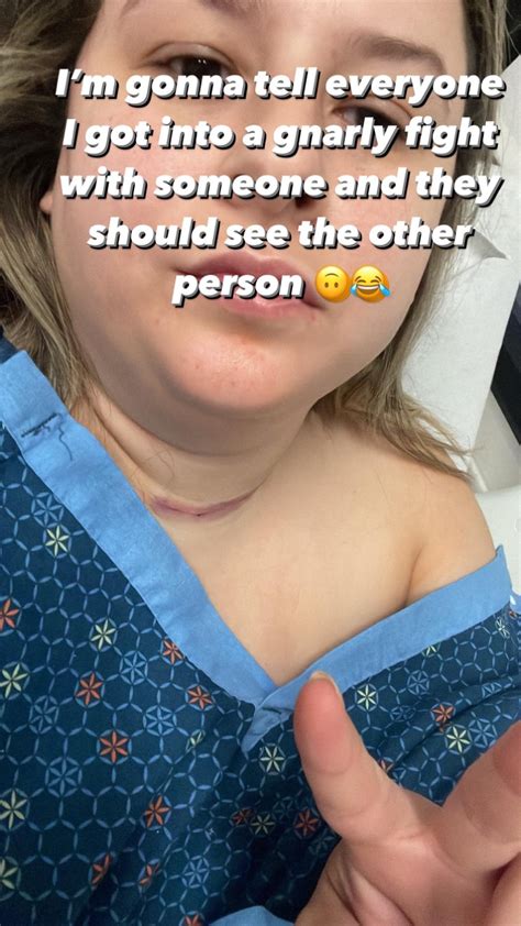 12 Hours Post Thyroidectomy R Thyroidectomy