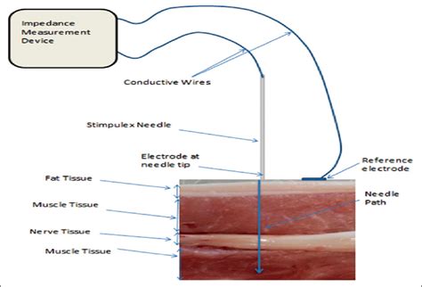 saudi journal of anaesthesia
