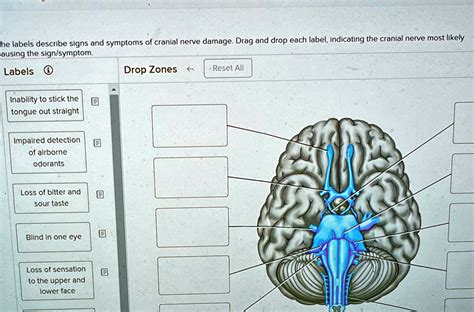GET ANSWER The Labels Describe Signs And Symptoms Of Cranial Nerve Damage Drag And Drop Each