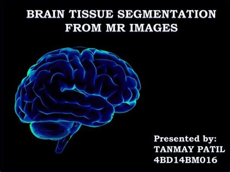 brain tissue segmentation from mr images ppt