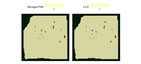 About Cell Type For Middle Temporal Gyrus Reference Dataset Technical
