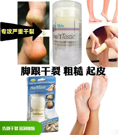 Heel Tastic Heel Repair Cream Winter Foot Ointment Say Goodbye To
