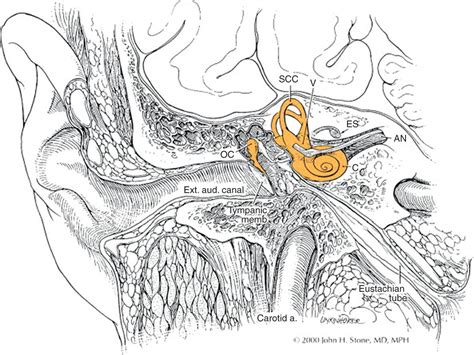 Otology Anatomy And Embryology With Radiology Correlates Clinical Tree