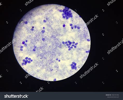 There Two Main Types Malaria Parasites Stock Photo Shutterstock