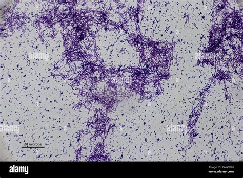 Bacteria Cells Under A Microscope Stock Photo Alamy