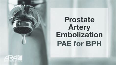 Ara Diagnostic Imaging Shares How Prostate Artery Embolization Provides Minimally Invasive