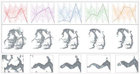 10 Iso Surface Extraction Of A Vascular Tree From A Ct Scan Five Download Scientific Diagram