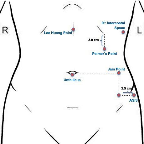 Laparoscopic Entry Techniques Article Glowm