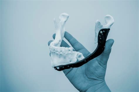 손에 들고 있는 사람 3d 인쇄된 플라스틱 프로토타입 인간 아래턱 및 의료용 티타늄 임플란트 근접 촬영 보형물 금속 분말로